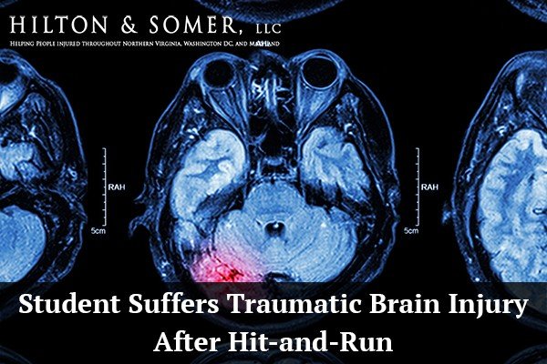 Student Suffers Traumatic Brain Injury After Hit-and-Run